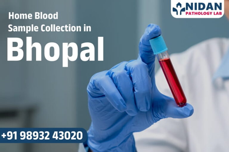 Home Blood Sample Collection in Bhopal | Book Lab Test at Home